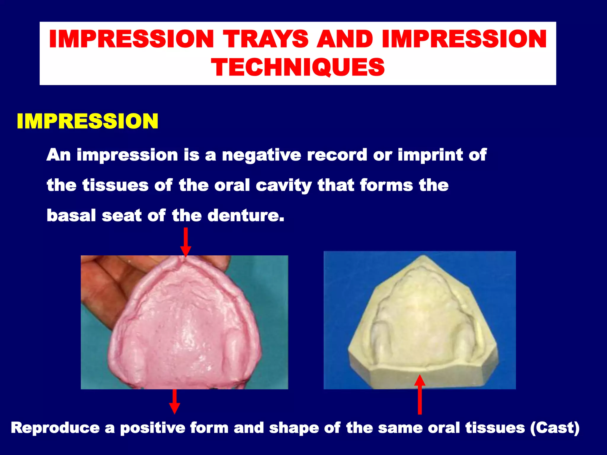 II. impression making for complete denture | PPT