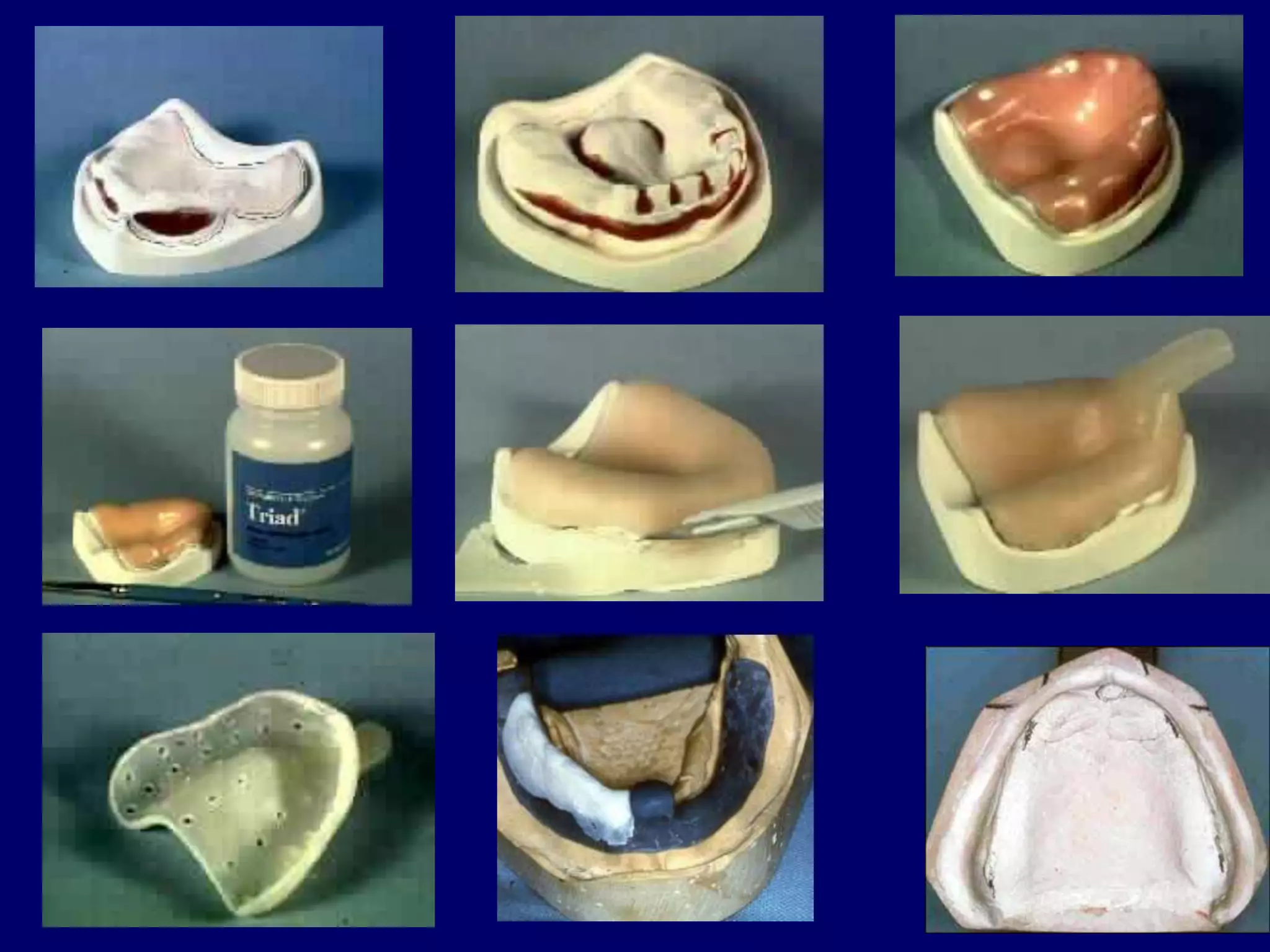 II. impression making for complete denture | PPT