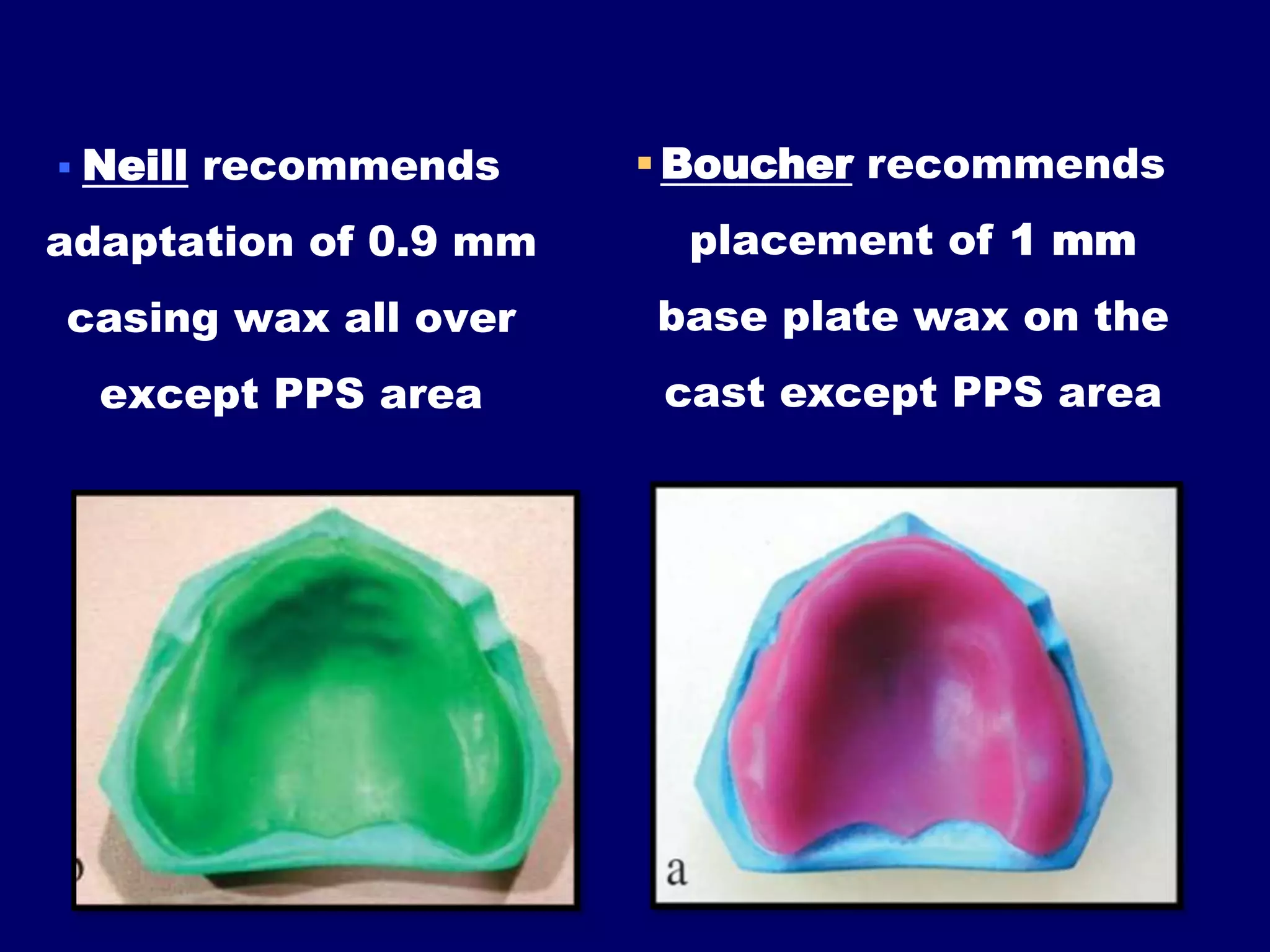 II. impression making for complete denture | PPT
