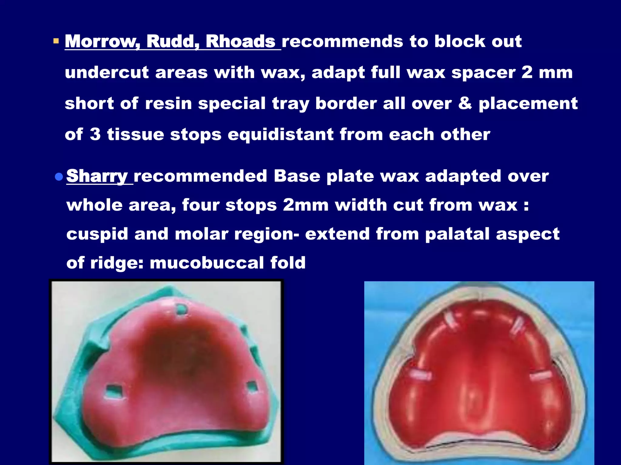 II. impression making for complete denture | PPT