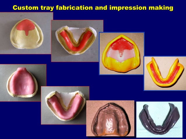 II. impression making for complete denture | PPT | Dental Health | Diseases and Conditions