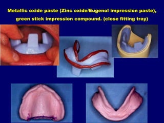 II. impression making for complete denture | PPT