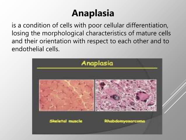 II. Introduction to cellular aberration.pptx | Cancer | Diseases and ...