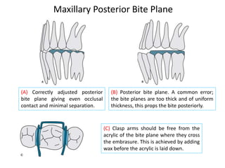 Orthodontics II | PPTX