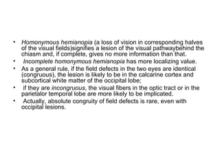 IIcranial nerve | PPT