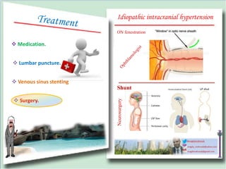 Idiopathic intracranial hypertension | PPSX