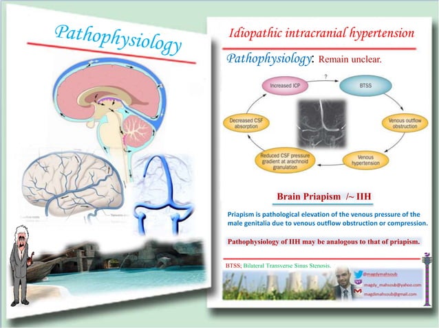 Idiopathic intracranial hypertension | PPSX | Brain and Nervous System ...
