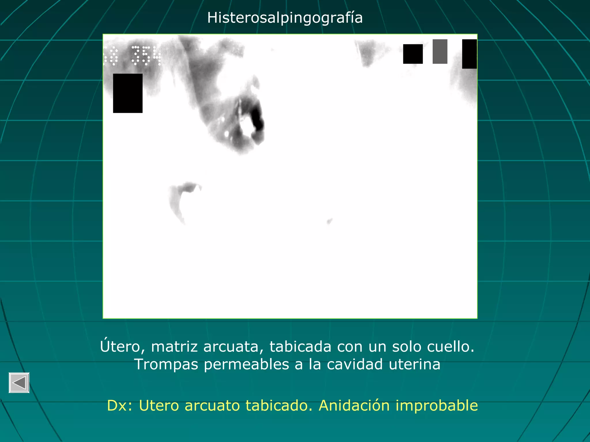 III el proceso de diagnostico radiologico-signos | PPT