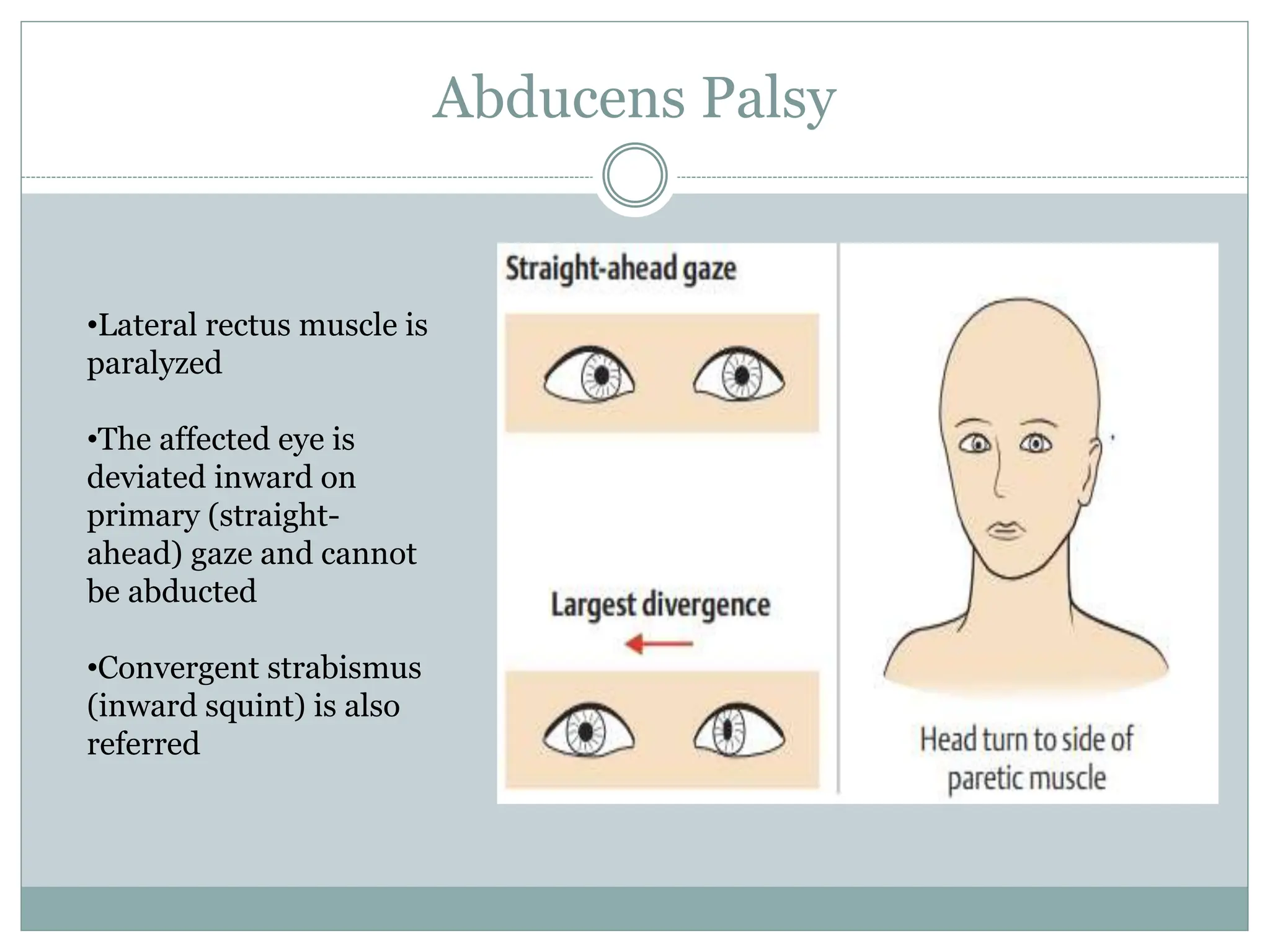 III, IV, VI Cranial nervess on the movement of eye | PPTX