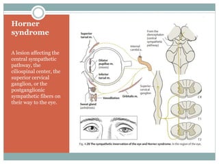 III, IV, VI Cranial nervess on the movement of eye | PPT