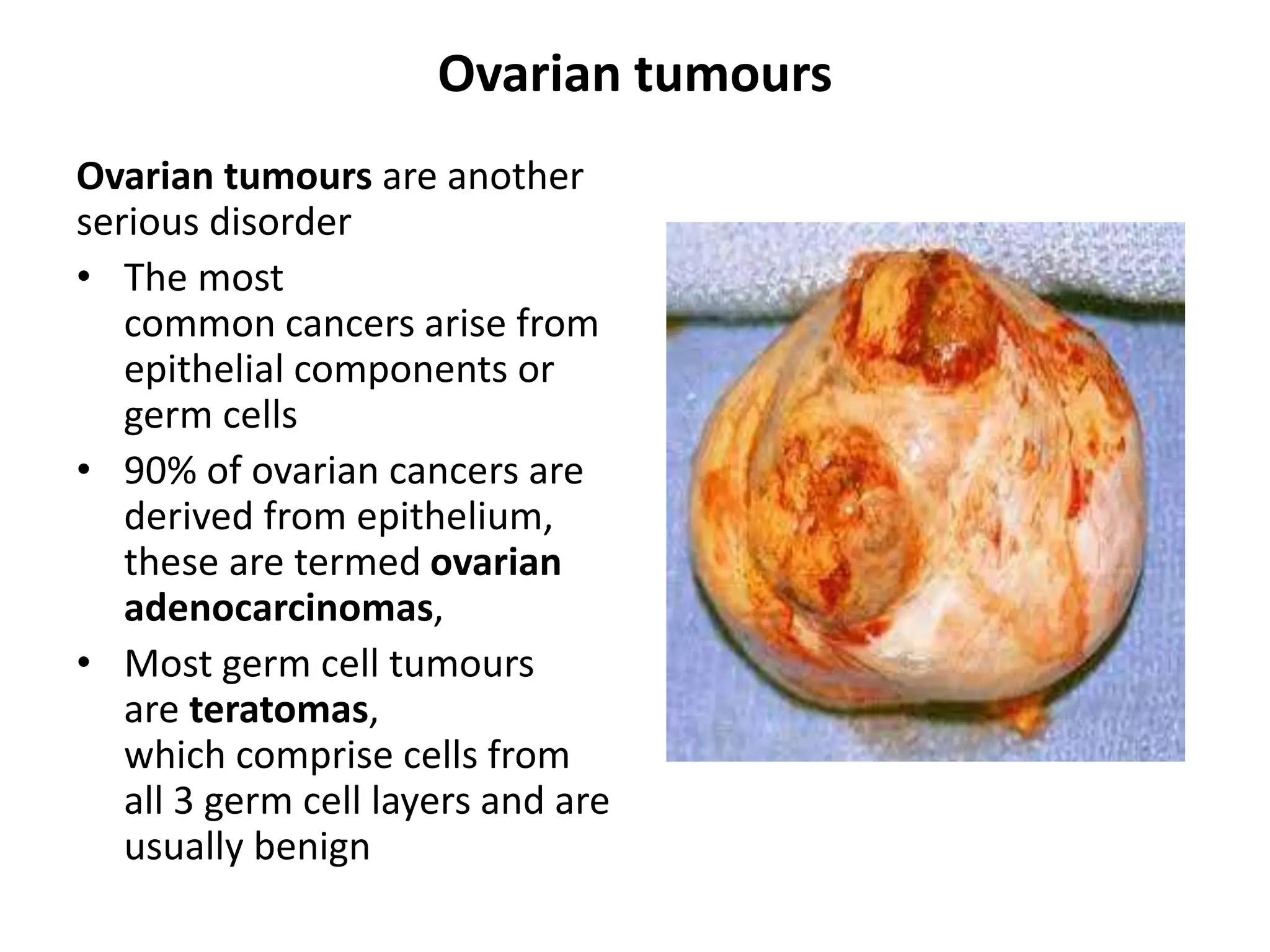 (iii) The internal Female Reproductive Organs (Fallopian Tube and ...