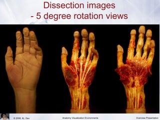 Anatomy Visualization and Interaction | PPT