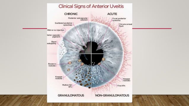 IIM- How to diagnose Uveitis.pptx