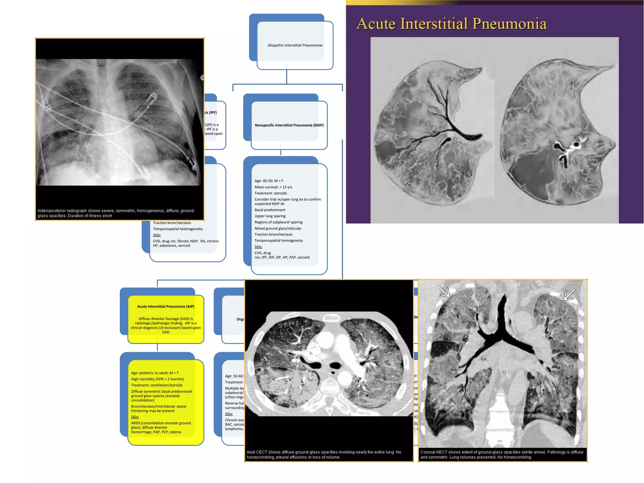 Idiopathic Interstitial Pneumonia | PPTX