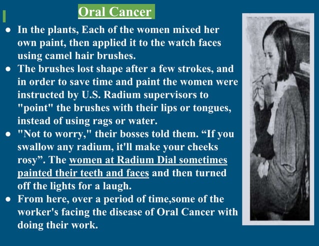 Radium dial painters and Oral Cancer | PPTX