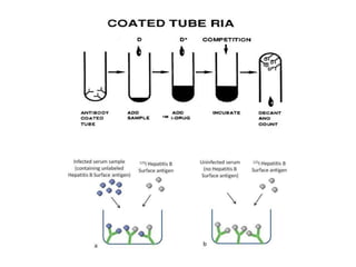 Radioimmunoassay Diagram