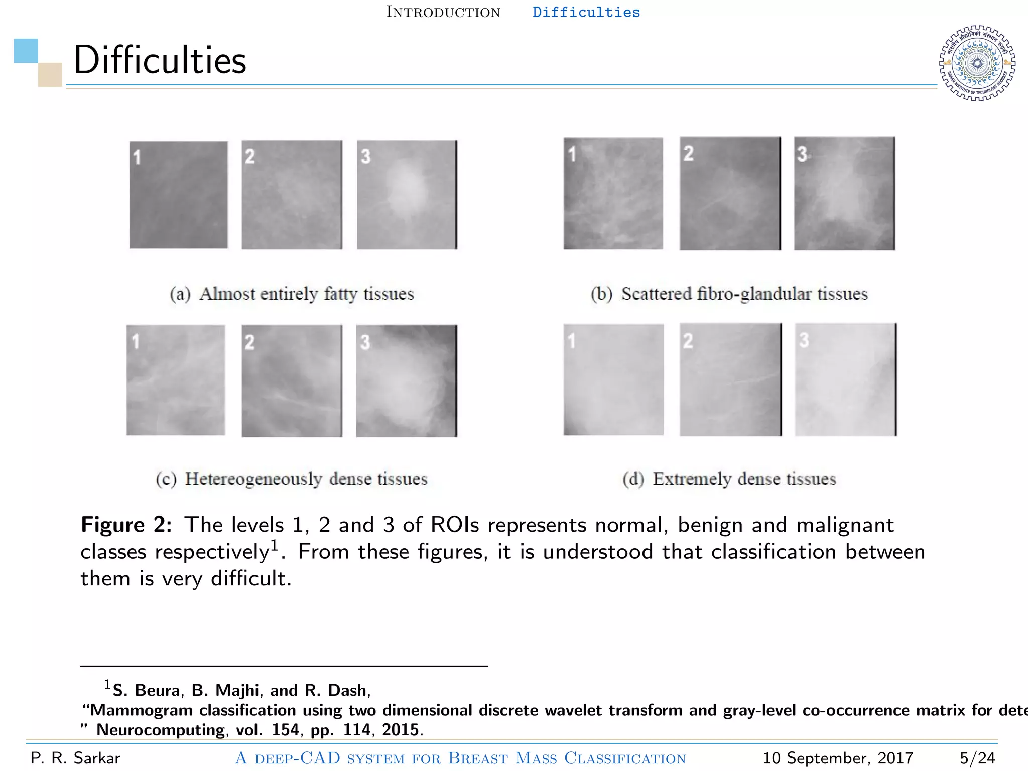 Classification Of Breast Masses Using Convolutional Neural Network As Feature Extractor And