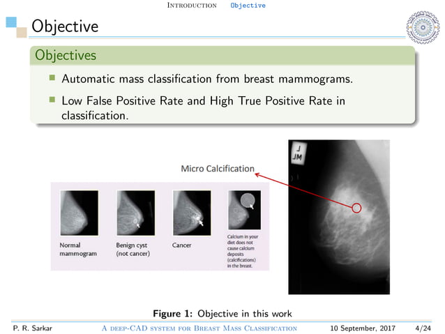 Classification Of Breast Masses Using Convolutional Neural Network As Feature Extractor And