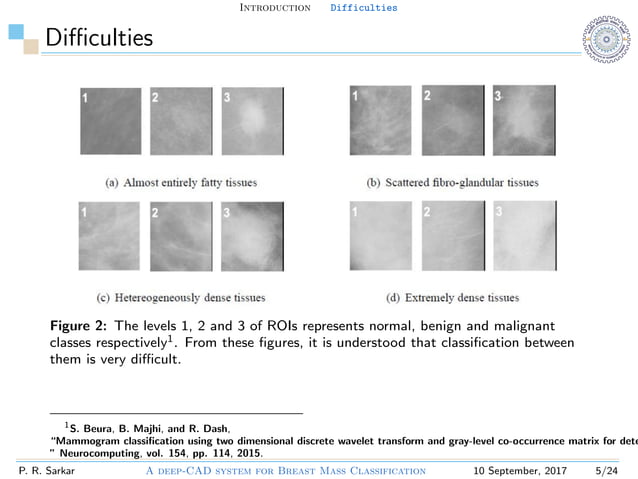 Classification Of Breast Masses Using Convolutional Neural Network As Feature Extractor And