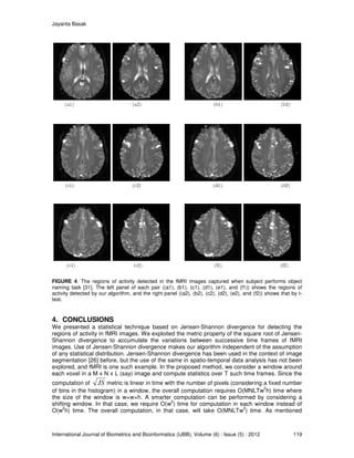 Detection of Neural Activities in FMRI Using Jensen-Shannon Divergence ...