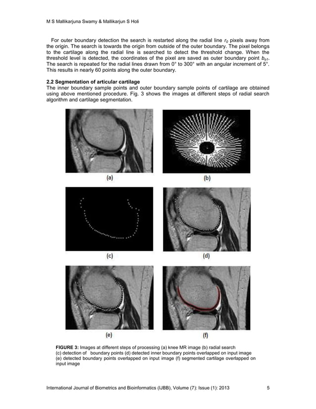 Knee Joint Articular Cartilage Segmentation using Radial Search Method, Visualization and ...