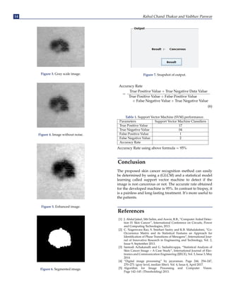 Skin Cancer Recognition Using SVM Image Processing Technique | PDF