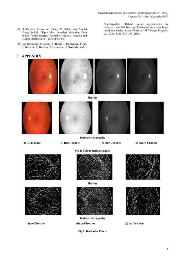IMPLEMENTATION OF IMPROVED GAUSSIAN FILTER ALGORITHM FOR RETINAL FUNDUS ...