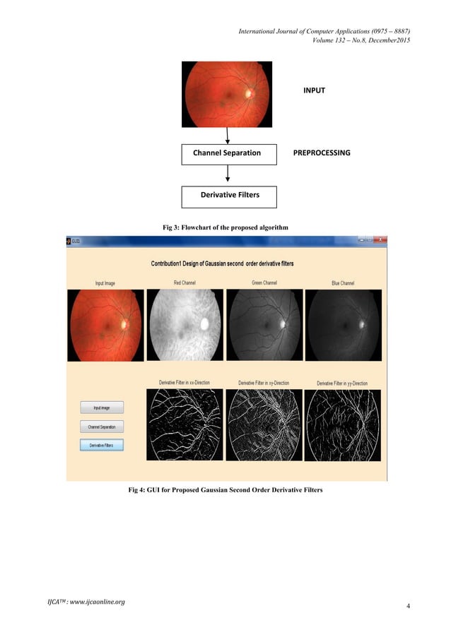 IMPLEMENTATION OF IMPROVED GAUSSIAN FILTER ALGORITHM FOR RETINAL FUNDUS IMAGES | PDF