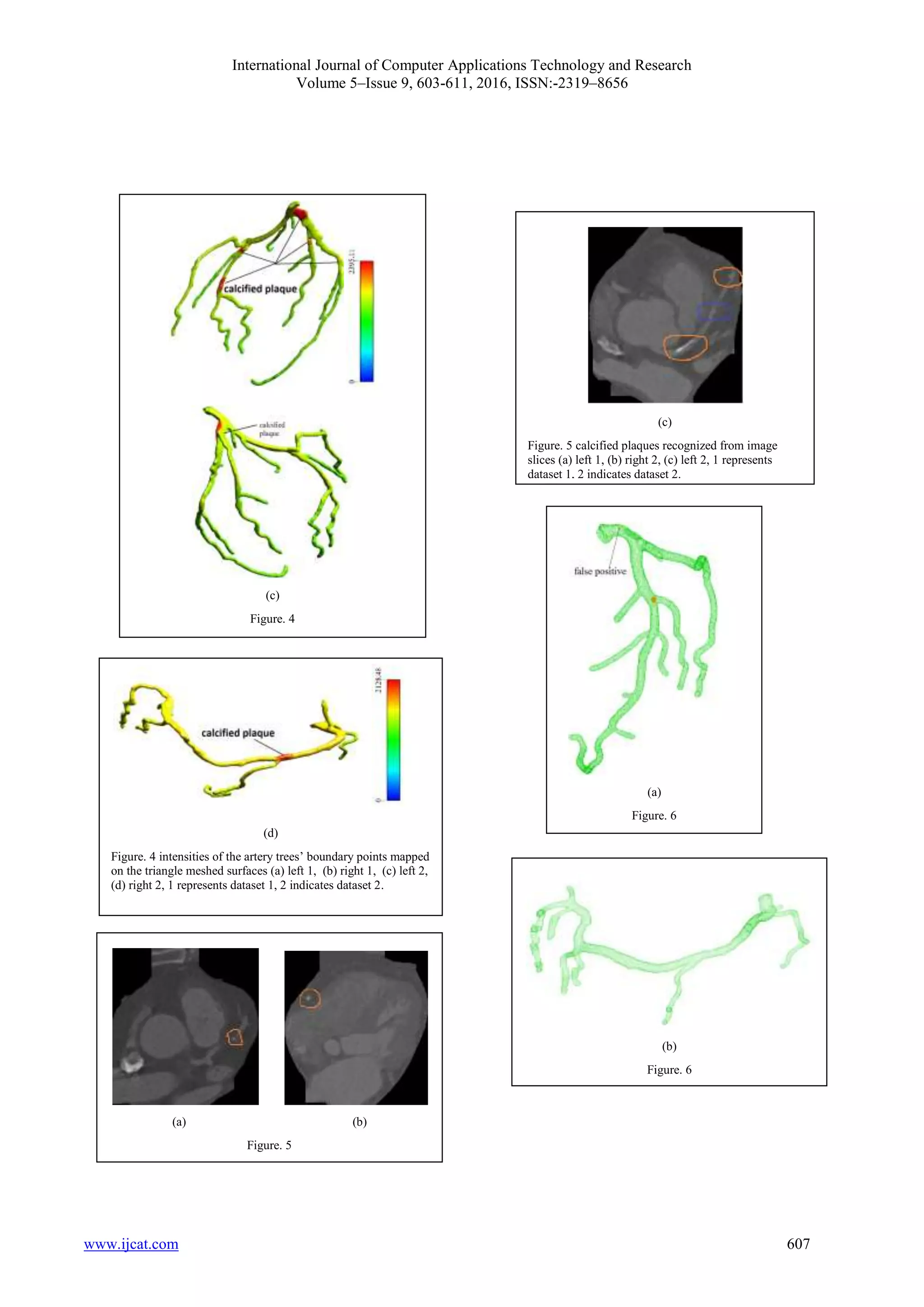 Segmentation and Visualization of Human Coronary Artery Trees from CTA Datasets | PDF
