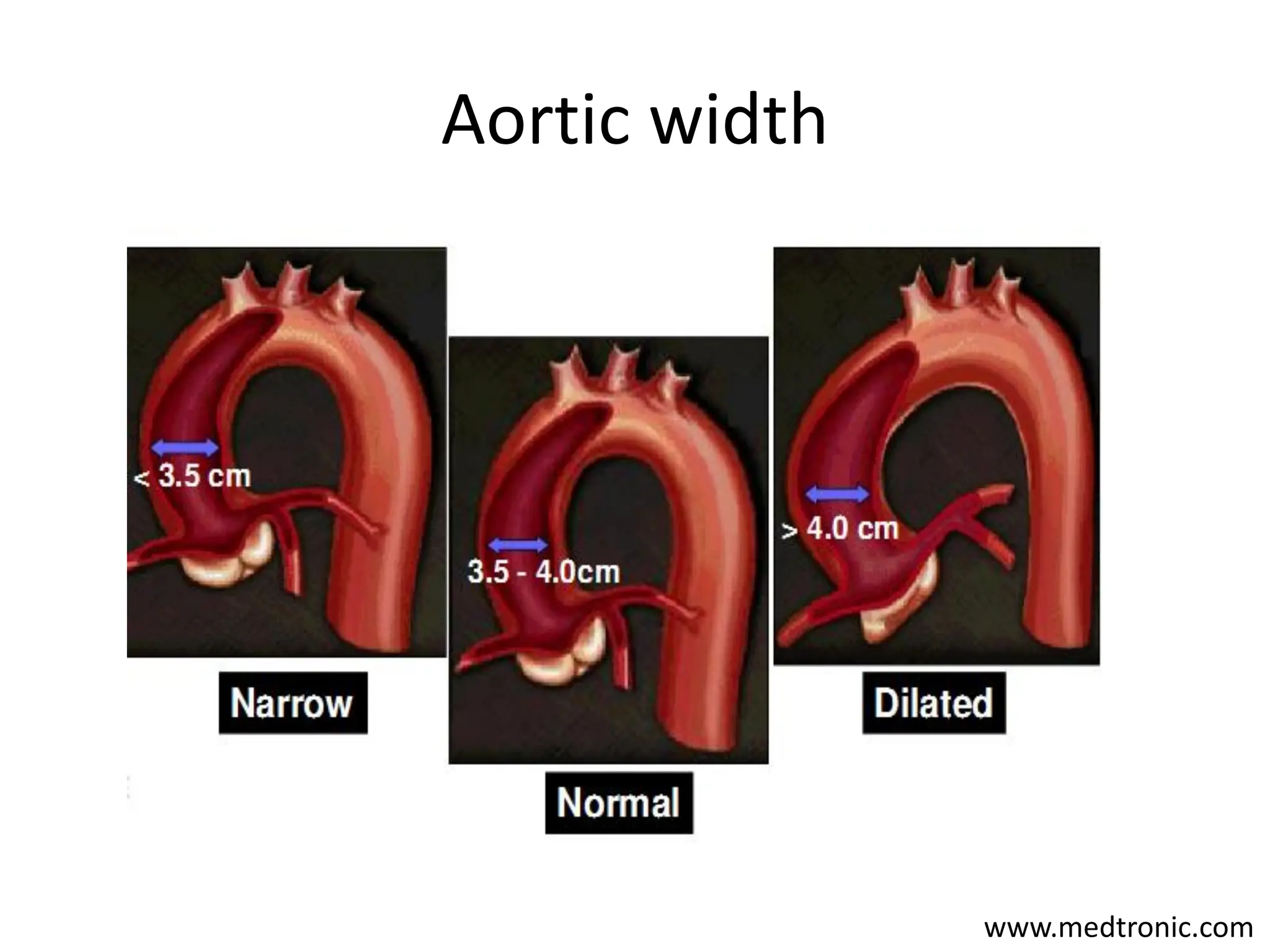 Know your instrument Guide for Angiography | PDF