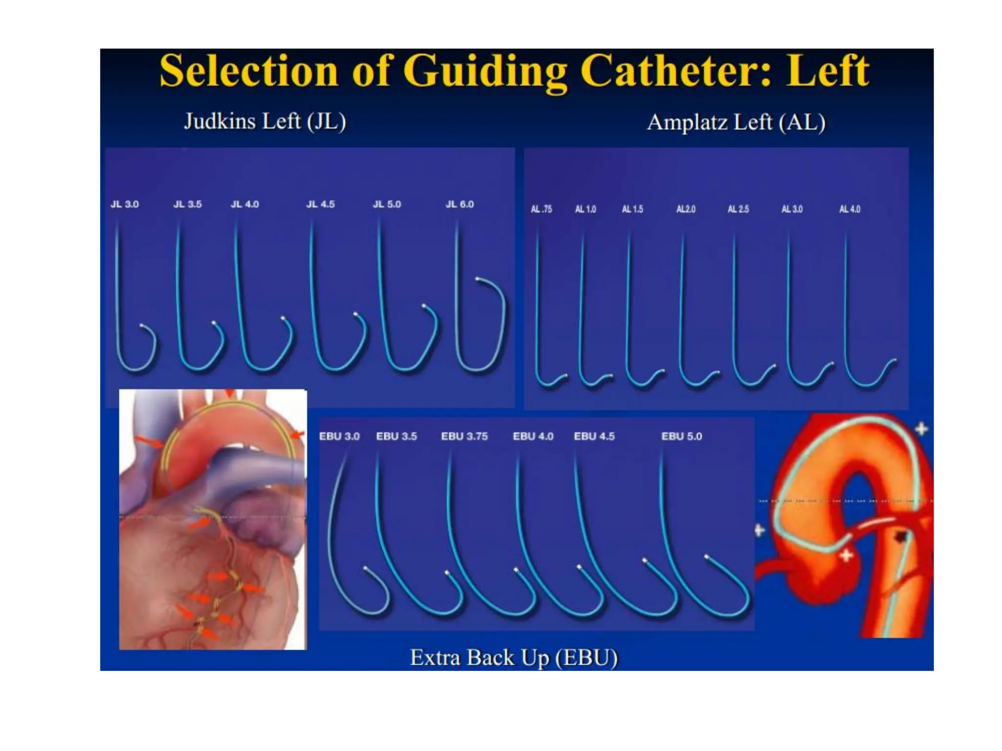 Know your instrument Guide for Angiography | PDF