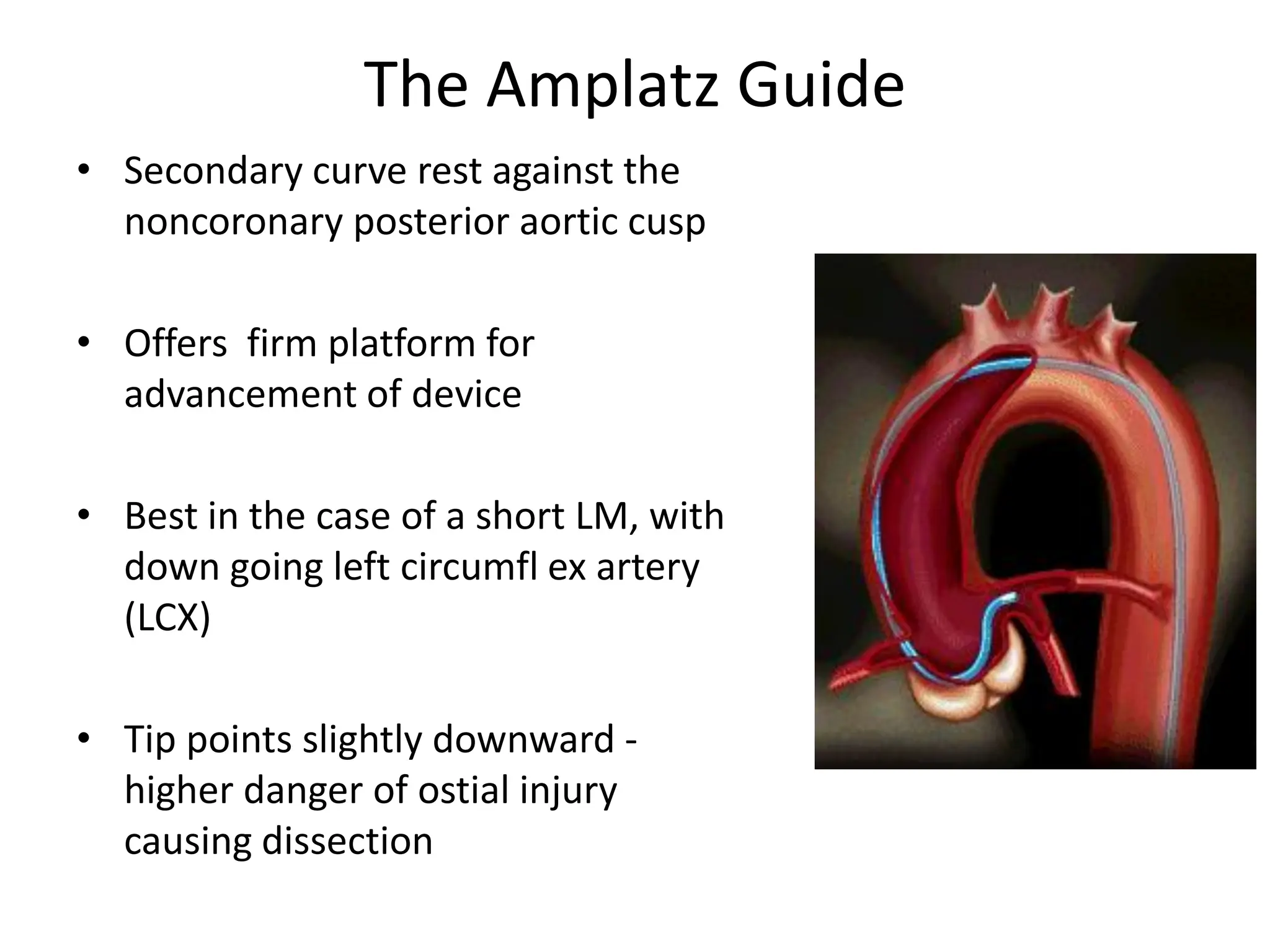 Know your instrument Guide for Angiography | PDF