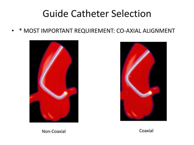 Know your instrument Guide for Angiography | PDF