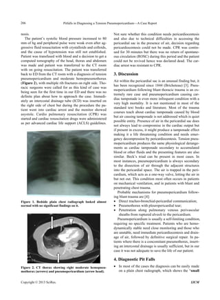 Pitfalls in diagnosing Tension Pneumopericardium | PDF