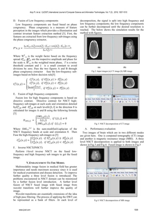 Medical image fusion based on NSCT and wavelet transform | PDF