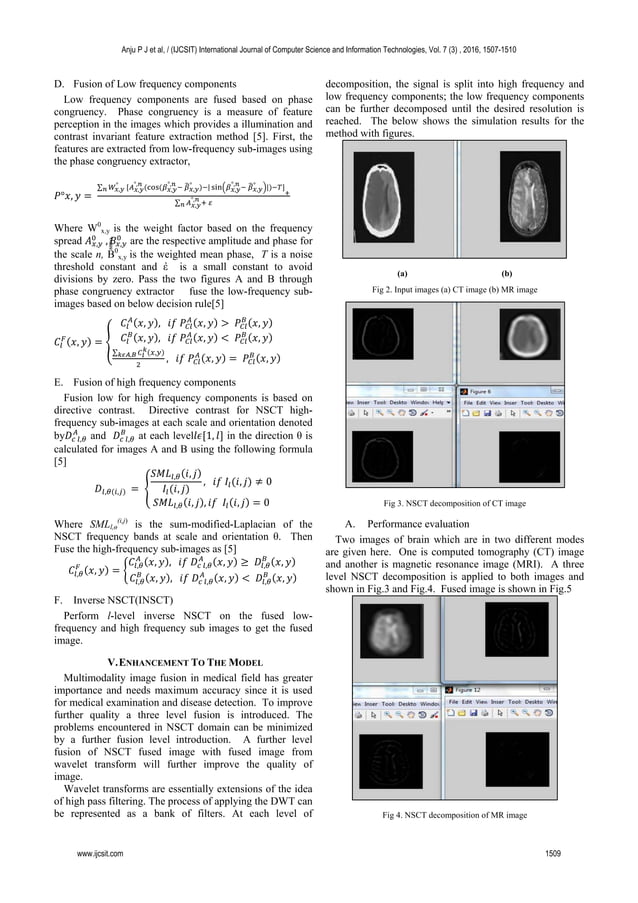 Medical image fusion based on NSCT and wavelet transform | PDF