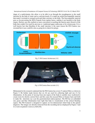 STRUCTURAL DYNAMICS AND EVOLUTION OF CAPSULE ENDOSCOPY (PILL CAMERA ...