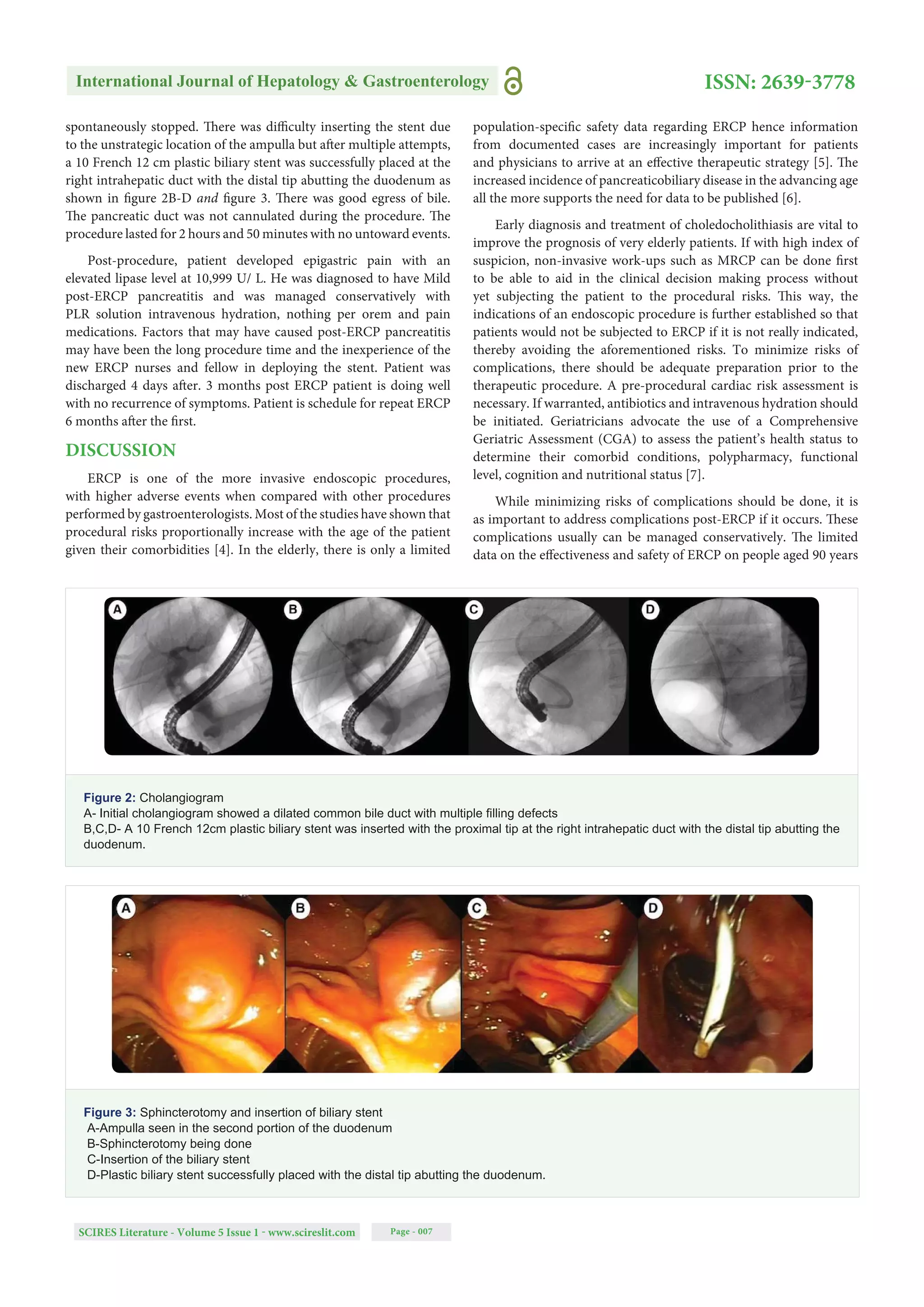 International Journal of Hepatology & Gastroenterology | PDF