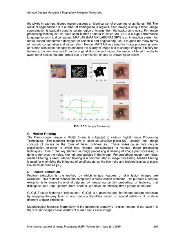 Computer Vision for Skin Cancer Diagnosis and Recognition using RBF and ...