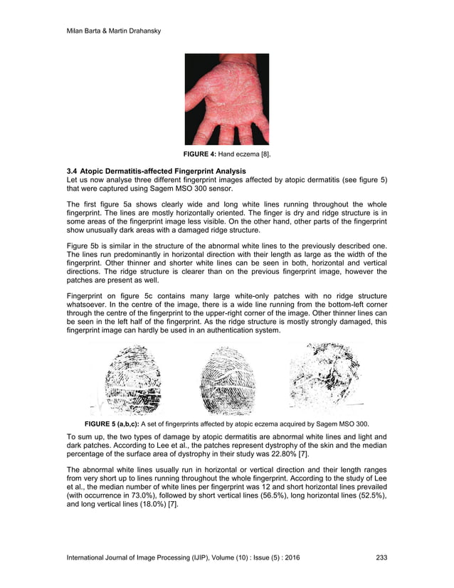 Generation of Skin Diseases into Synthetic Fingerprints | PDF ...