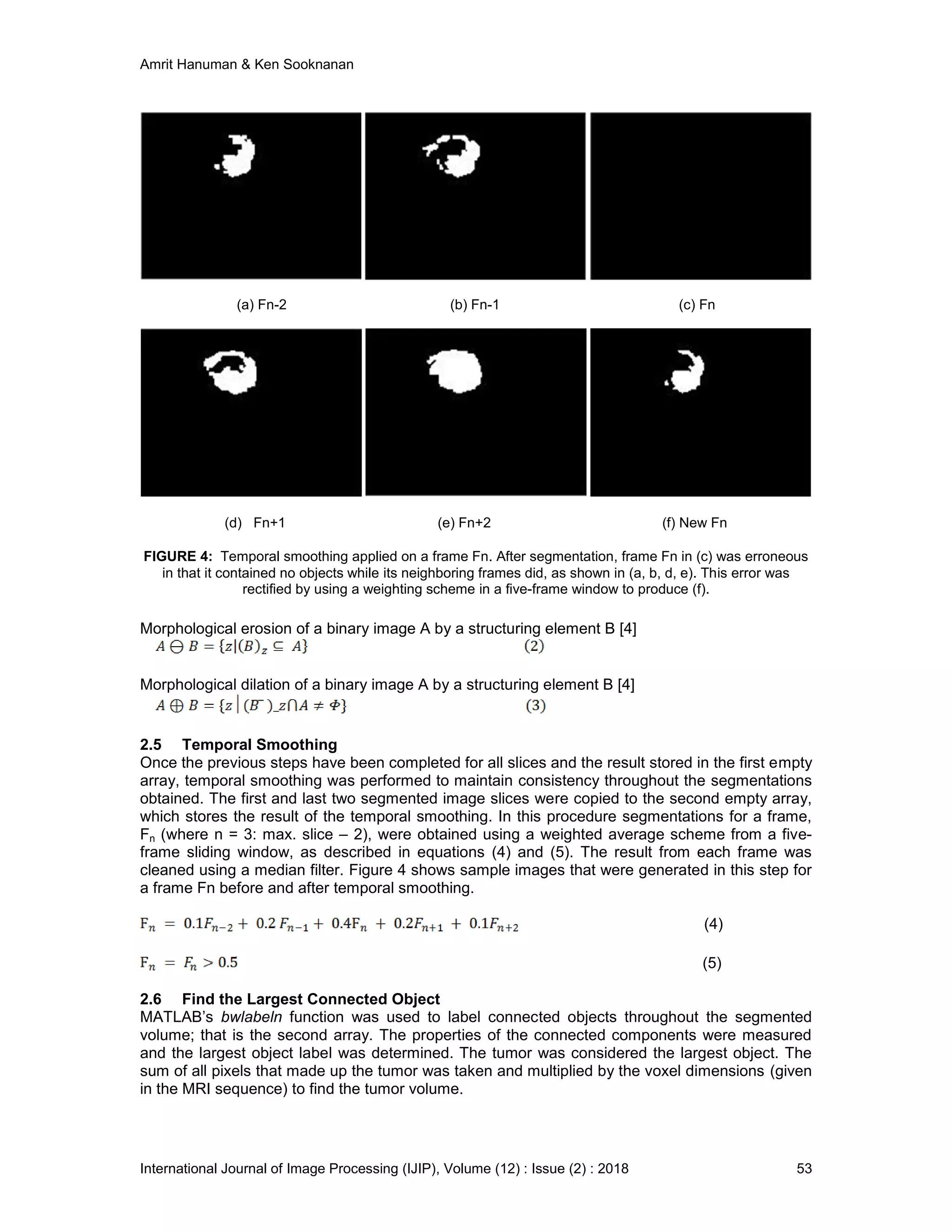 Brain Tumor Segmentation And Volume Estimation From T1 Contrasted And