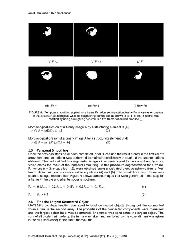 Brain Tumor Segmentation and Volume Estimation from T1-Contrasted and ...