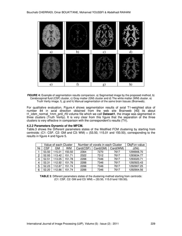 Fully Automatic Method for 3D T1-Weighted Brain Magnetic Resonance Images Segmentation | PDF