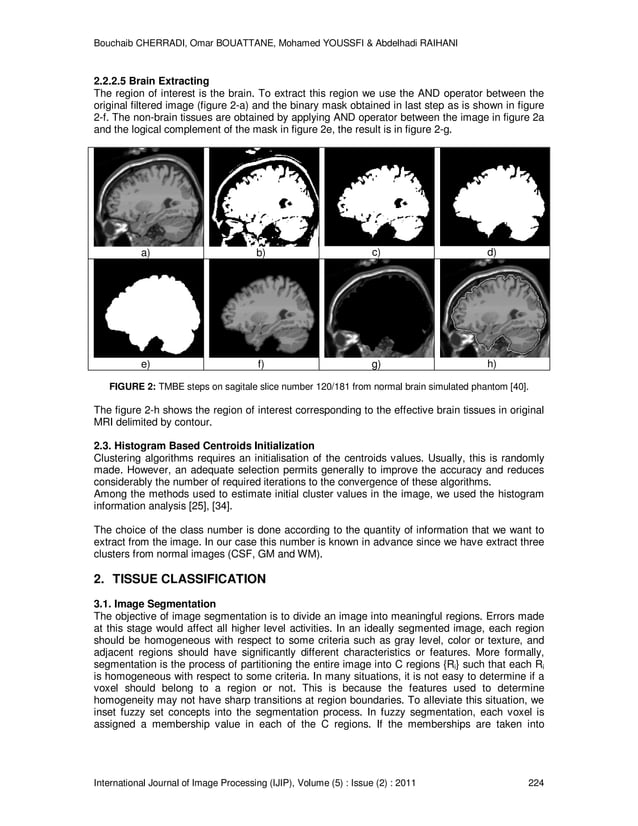 Fully Automatic Method for 3D T1-Weighted Brain Magnetic Resonance Images Segmentation | PDF