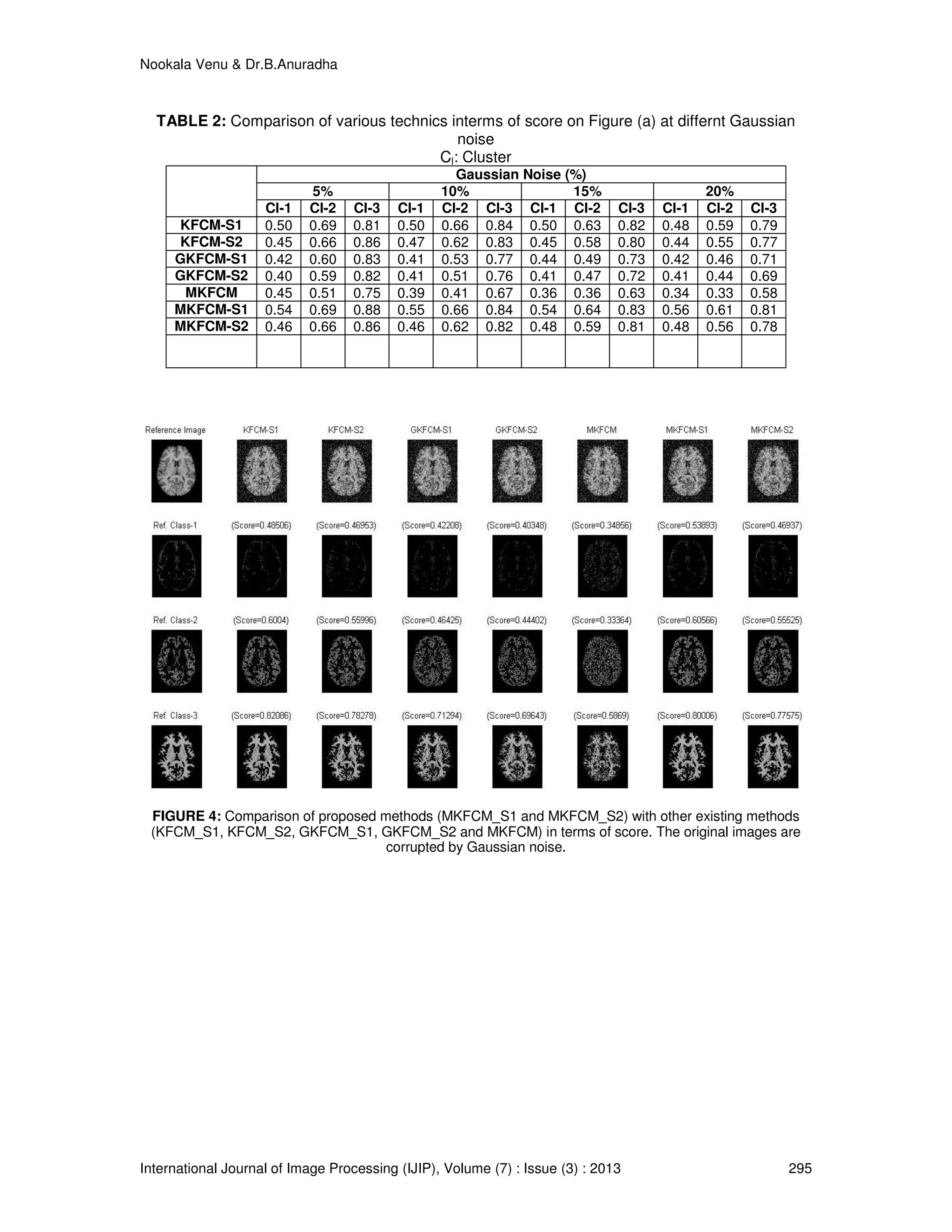 A Novel Multiple Kernel Based Fuzzy C Means Algorithm With Spatial