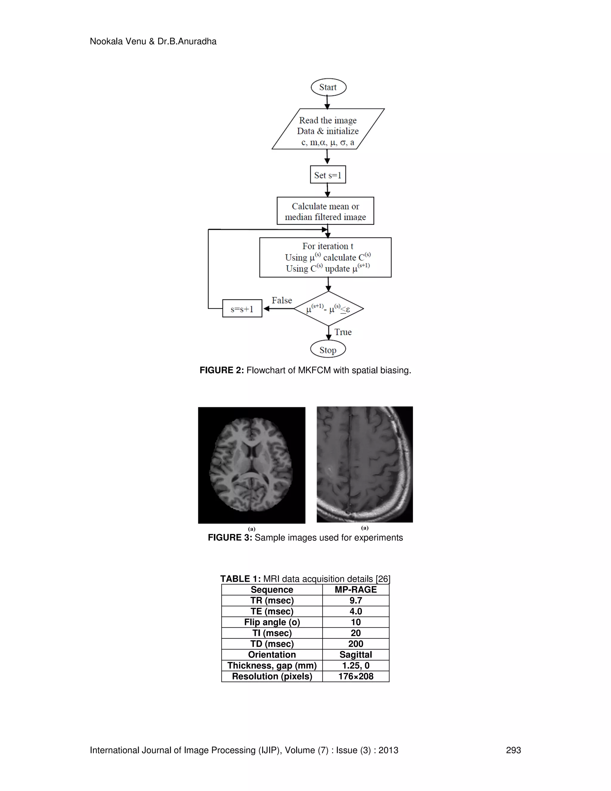A Novel Multiple Kernel Based Fuzzy C Means Algorithm With Spatial