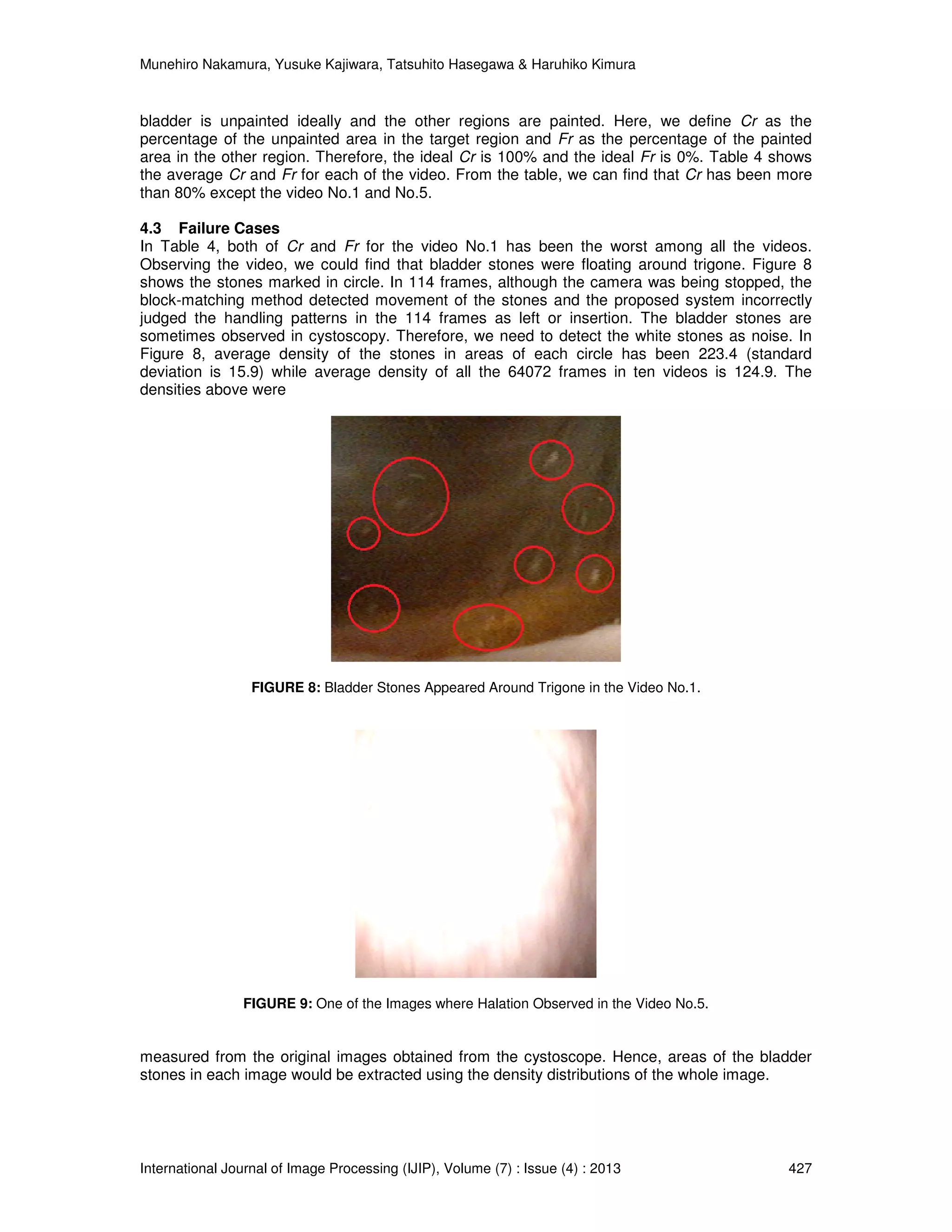 3D Position Tracking System for Flexible Cystoscopy | PDF