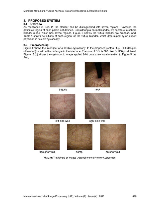 3D Position Tracking System for Flexible Cystoscopy | PDF | Cameras and ...