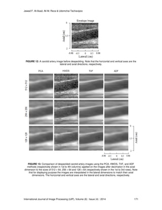 An Ultrasound Image Despeckling Approach Based on Principle Component Analysis | PDF