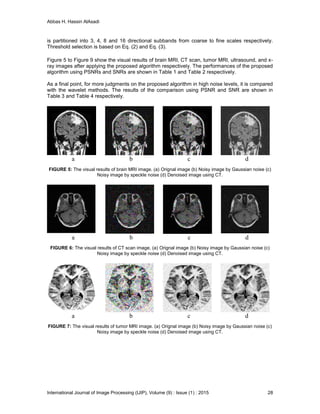 Contourlet Transform Based Method For Medical Image Denoising | PDF